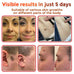 The MicroDerm Patch - Painless Skin Tag & Blemish Removal + 50% OFF ...
