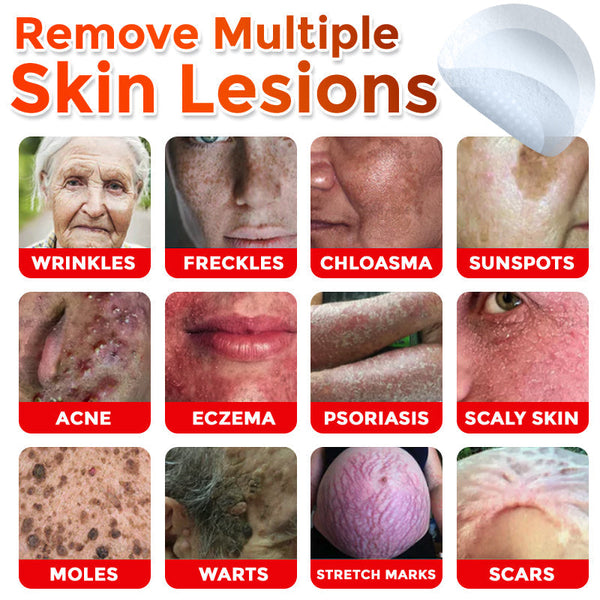 The MicroDerm Patch - Painless Skin Tag & Blemish Removal + 50% OFF ...